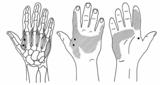 Alles over pijn in de hand- oorzaken en behandeling