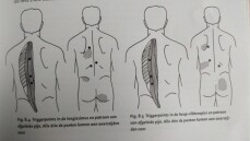 Alles over midden rugpijn- oorzaak en behandeling