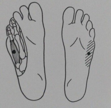 Pijn in de voet; wat is de oorzaak? En hoe los je het op?