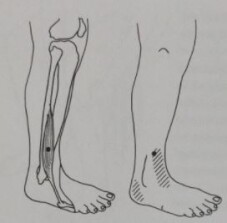Alles over pijn in het scheenbeen- oorzaken en behandeling