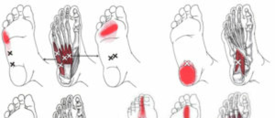 Beknelde zenuw oorzaak en behandeling nummer 1 weten? Ontdek het hier!