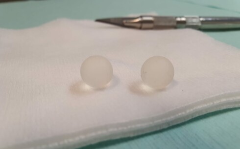 Boegroe laten plaatsen bij cash and glory