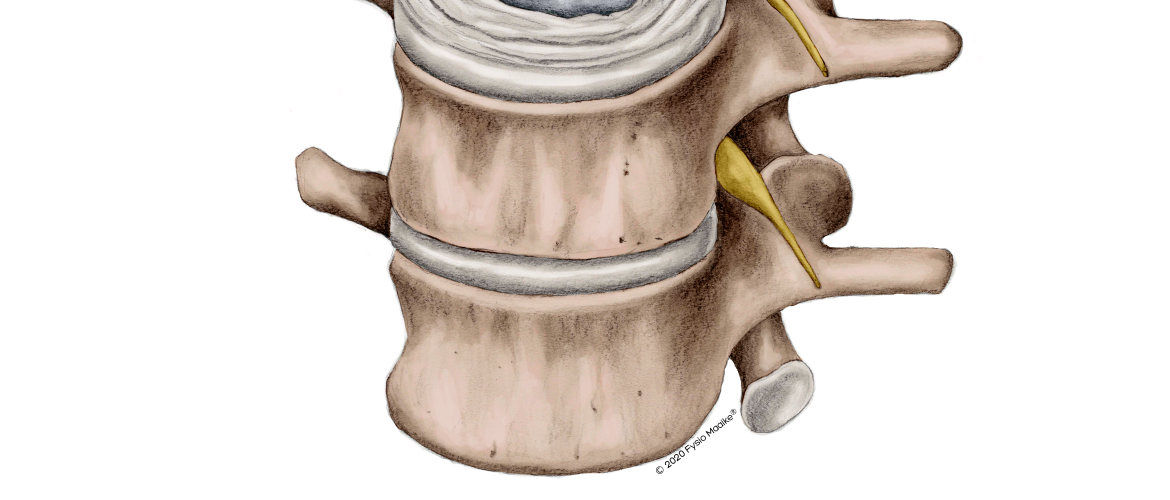 Klachten na Spondylodese | Hoe herstellen van deze operatie aan de rug