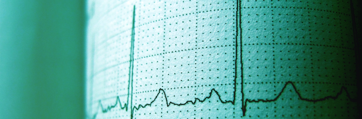 Veel voorkomende hartritmes op de IC