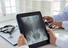 Rontgenfoto Lage Rug? Wanneer WEL/NIET? | Door de Lage Rugpijn Fysio