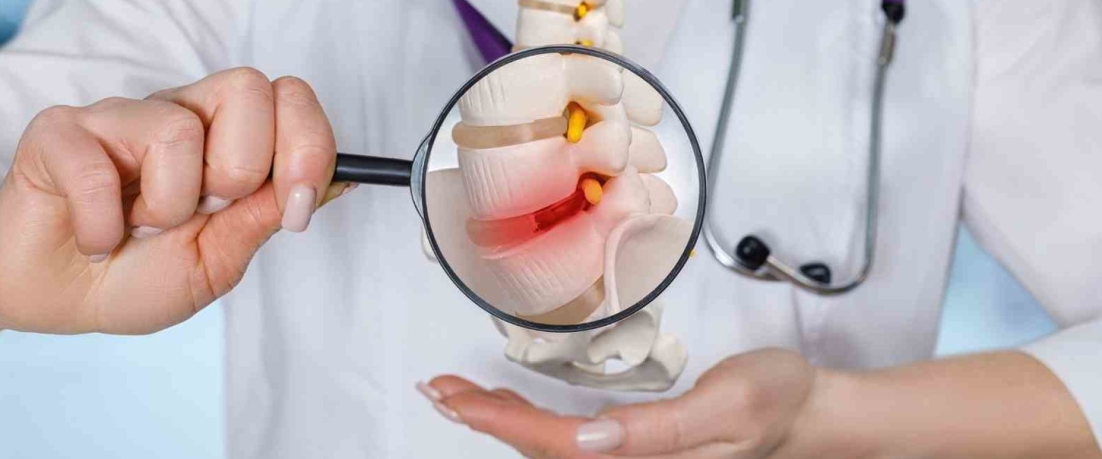 Kromme Rug? Wat te Doen?! | Door de Lage Rugpijn Fysio