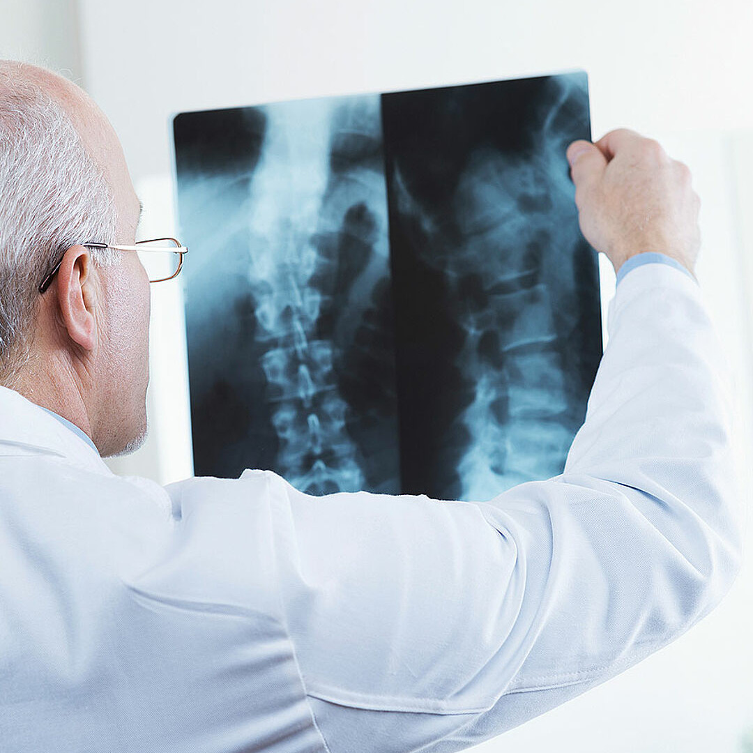 Rontgenfoto van de lage rug