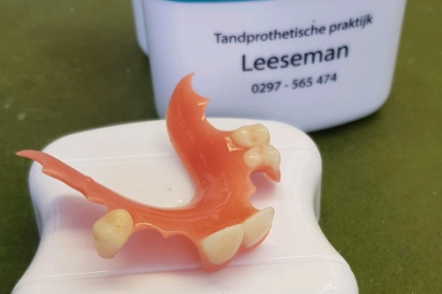 Kunstgebit & Gebitsprotheses | Tandprothetische Praktijk