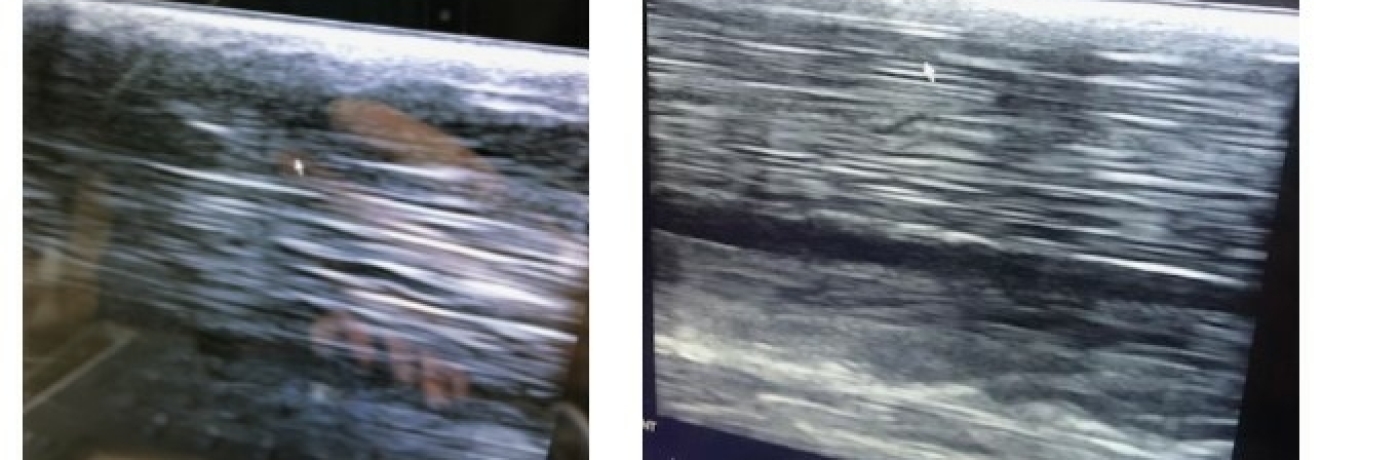 Het Belang van Pezen bij Paarden: Anatomie, Blessures en Behandeling