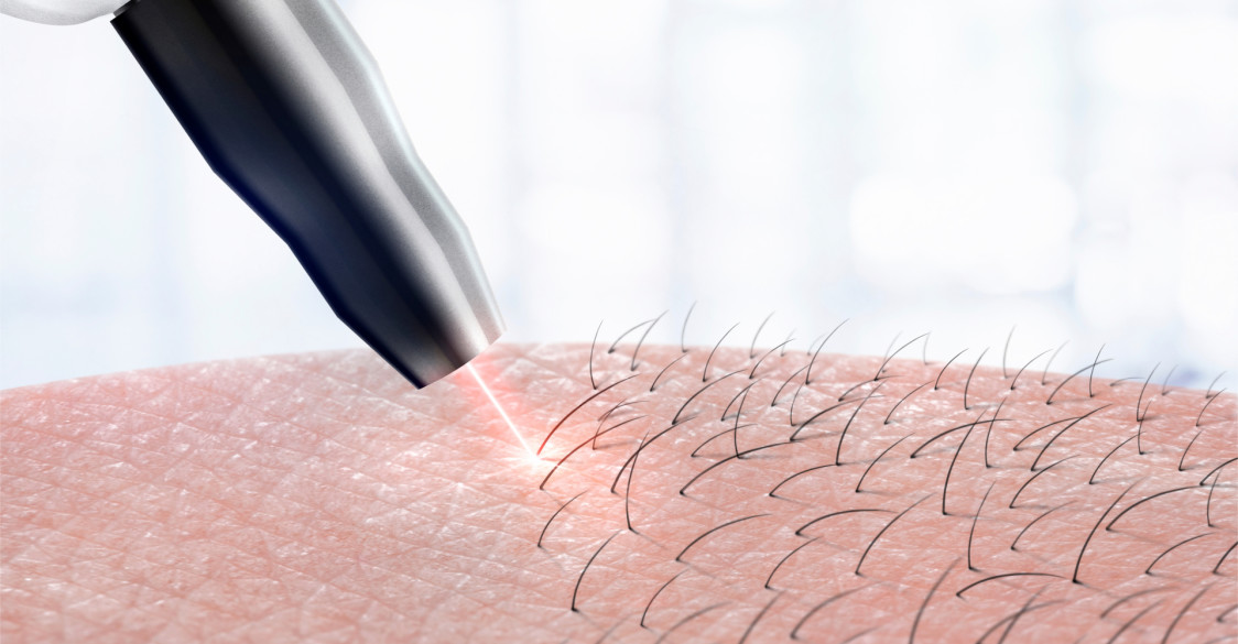 elektrisch epileren voor alle haar en huidtypen reserveer hier uw afspraak