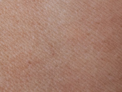 Huidproblemen | Mijn tips | Sproet