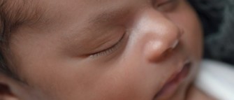 Intertrigo: smetplekken onder de plooien