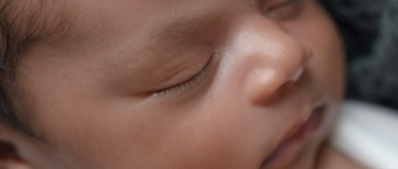 Intertrigo: smetplekken onder de plooien