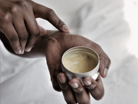 Wondroos | Oorzaak en behandeling | Sproet