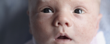 Baby acne | Oorzaak en tips | Sproet