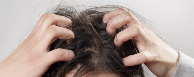 Bultjes op hoofdhuid | Oorzaken en oplossingen | Sproet