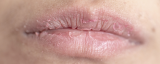 Droge lippen | Verminder droge lippen in 5 stappen | Sproet