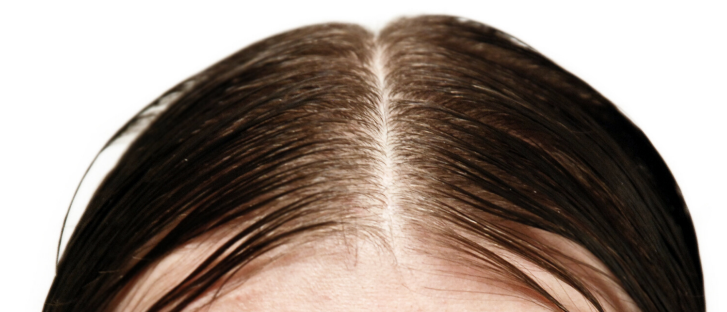 Glimmend, vet haar | Oorzaak en tips | Sproet