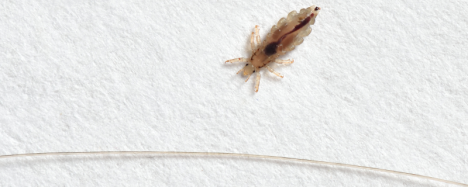 Luizen | Oorzaak, herkennen, behandelen | Sproet