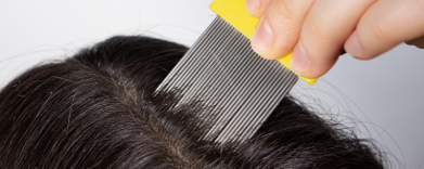 Luizen | Oorzaak, herkennen, behandelen | Sproet