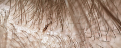 Luizen | Oorzaak, herkennen, behandelen | Sproet