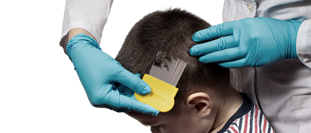 Luizen | Oorzaak, herkennen, behandelen | Sproet