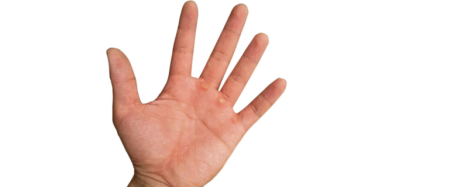 Eelt op hand | Oorzaak en tips | Sproet