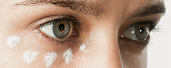 Dermatitis periocularis | Rode uitslag rond ogen | Sproet