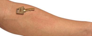 Jeukende rode galbulten | Mijn tips! | Sproet