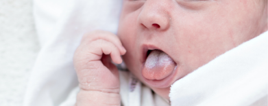 Spruw | Oorzaak en tips bij spruw baby | Sproet