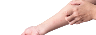 Eikenprocessierups bultjes: wat te doen? | Sproet