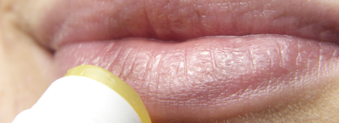 Liplik eczeem | Oorzaak en behandeling | Sproet