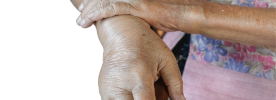 Lymfoedeem benen, arm | Behandelen | Sproet