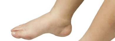 Lymfoedeem benen, arm | Behandelen | Sproet