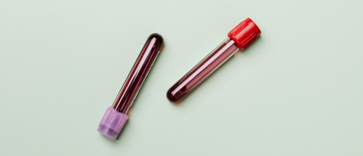 EMB-bloedtest, wat wordt er gemeten?