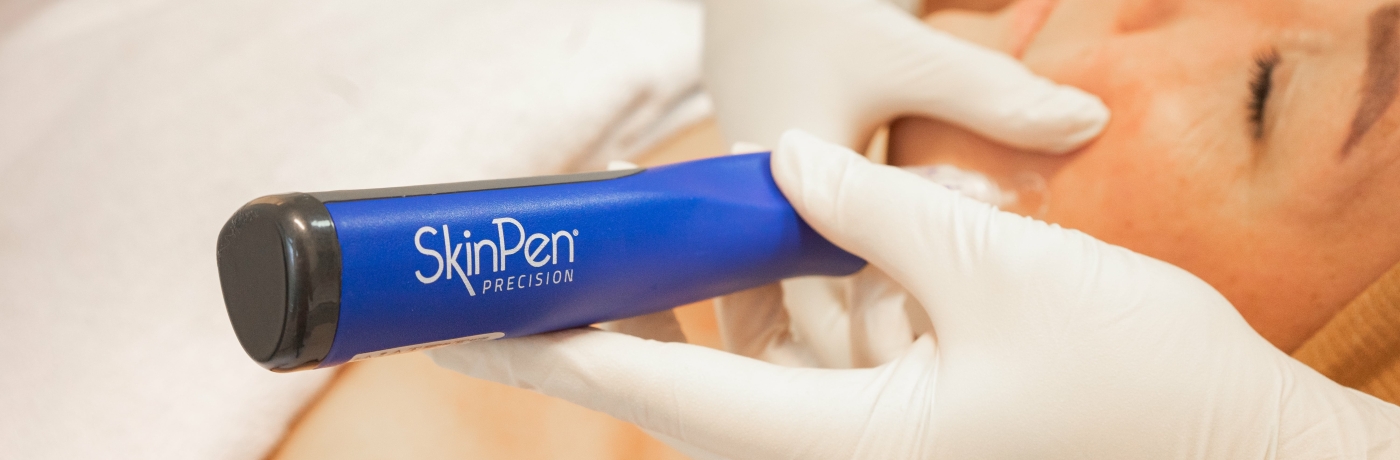 Ontdek de kracht van SkinPen Microneedling tegen acne littekens ...