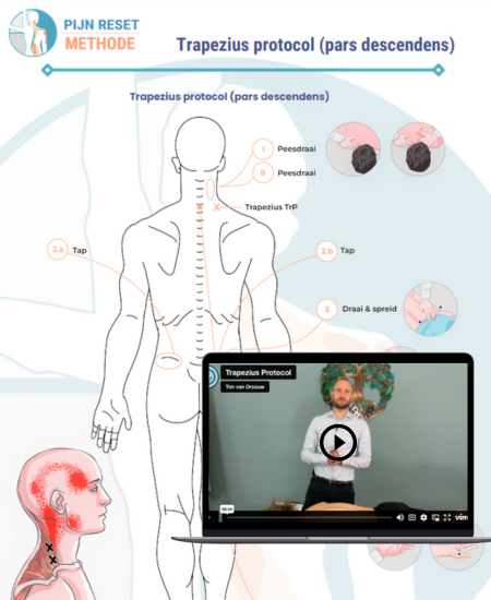 Trapezius protocol - Gratis download