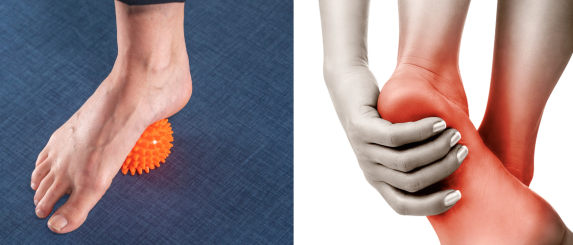 Fat pad syndroom behandel je met voet- en houdingsoefeningen